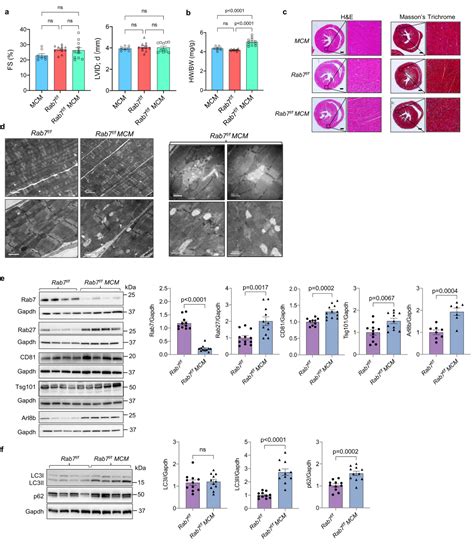 Nature子刊 线粒体在溶酶体受损时分泌到细胞外囊 美必思医学编译