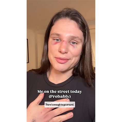 Ilona Maher Is ‘truly Not Ok After Breaking Nose In Rugby Match Us