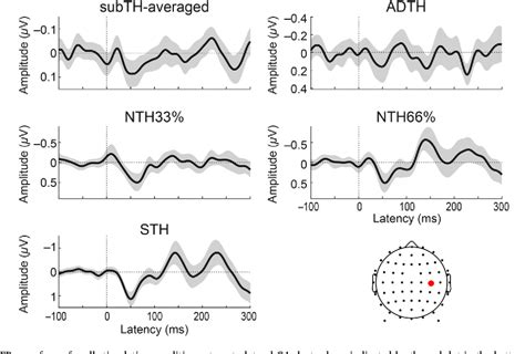 Figure 1 From Dissociable Neural Correlates Of Stimulation Intensity