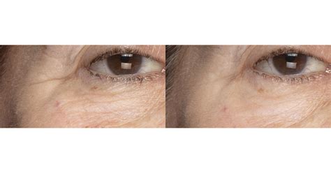 Delavie Sciences Launches Revolutionary Sculpting Cream As Part Of Age