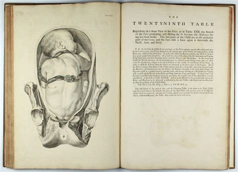 A Sett Of Anatomical Tables With Explanation And An Abridgement Of The Practice Of Midwifery