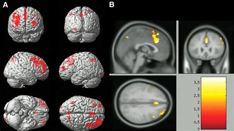 Modafinil Brain