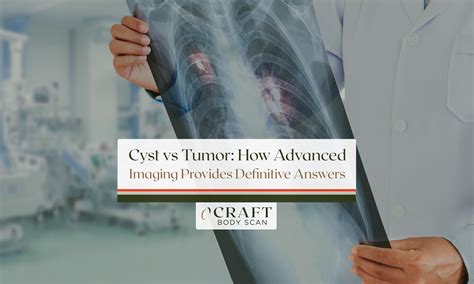 Cyst Vs Tumor How Advanced Imaging Provides Definitive Answers Craft Body Scan