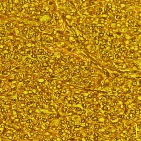 Normal Human Pancreas Tissue Stained With Hematoxylin And Eosin H And E