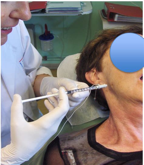 Temporo Mandibular Dysfunctions And Injections Atlas Of Science