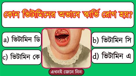 কোন ভিটামিনের অভাবে স্কাভি রোগ হয় জি কে প্রশ্ন ও উত্তর General