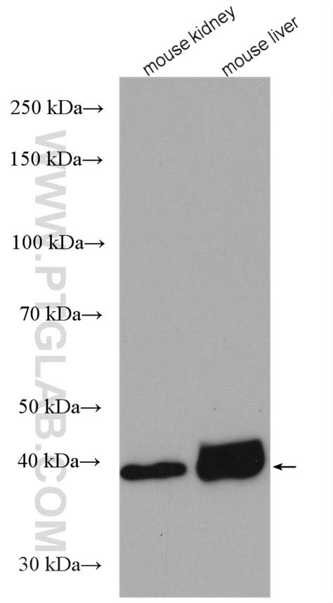 Gsnor Adh5 Antibody 11051 1 Ap Proteintech