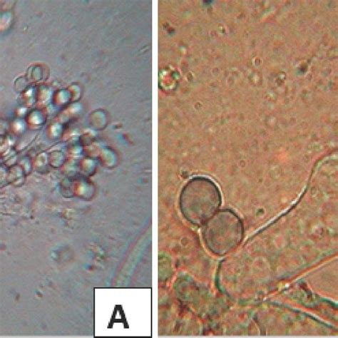 Conidia And Conidiophore Characters Of Amphobotrys Ricini A