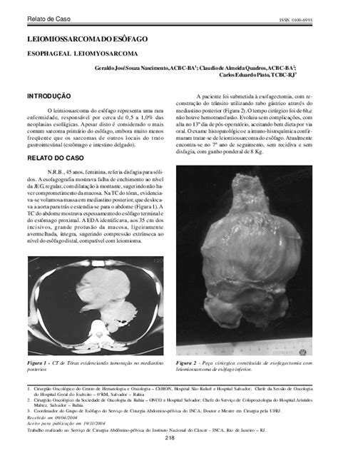 Pdf Esophageal Leiomyosarcoma