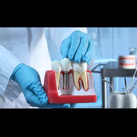 Understanding The Dental Implant Process Step By Step Guide