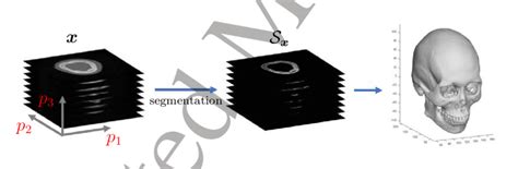 Illustration Of 3d Ct Image And Skull Image Our Landmark Detection Download Scientific Diagram