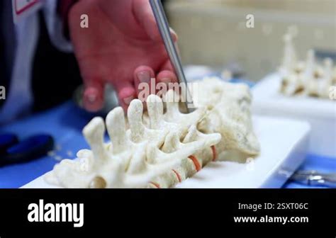 Neurosurgical Tool Is Used To Cut Off Little Pieces Of The Spine Model Close Up Displaying The