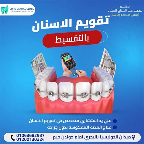 ابتسامتك أجمل بتقويم الأسنان 🌟 التقويم عندنا بالتقسيط بأحسن جودة و