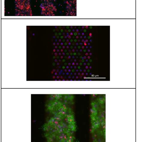Clogged Vycap Microfilters Aggregates Of Cells A Accumulation Of Download Scientific