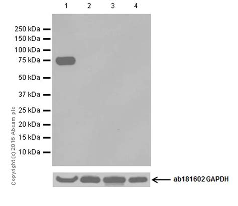 Anti Dopamine Beta Hydroxylase Antibody Epr20385 Ab209487 Abcam
