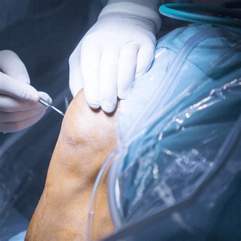 Expert Arthroscopy Surgeon In Gwalior Dr Yashasvi Bansal
