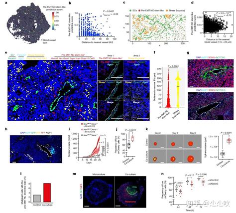 Nature发表黑色素瘤细胞状态多样性和轨迹的高分辨率时空图谱揭示黑色素瘤细胞的生长和转移机制 知乎