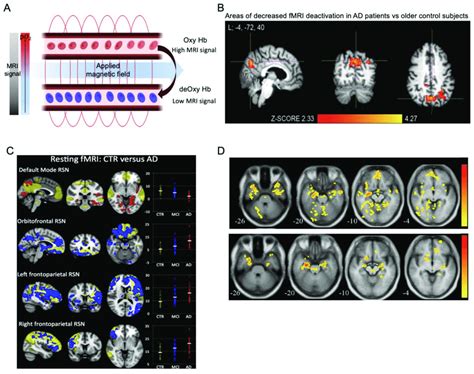 Fmri Imaging A Bold Effect In Mri B Areas Of Decreased Fmri Download Scientific Diagram