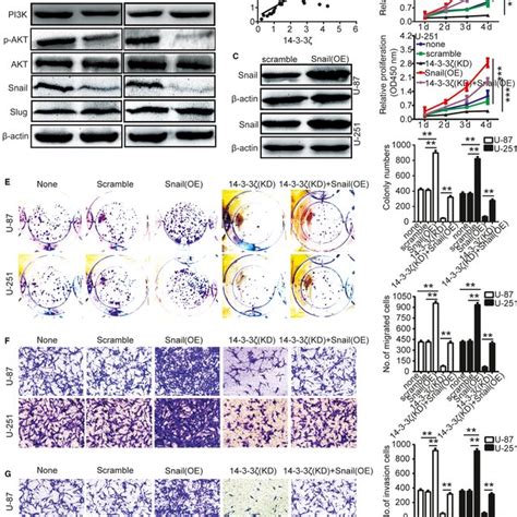 Knockdown of 1433ζ inhibits gliomas cells proliferation migration