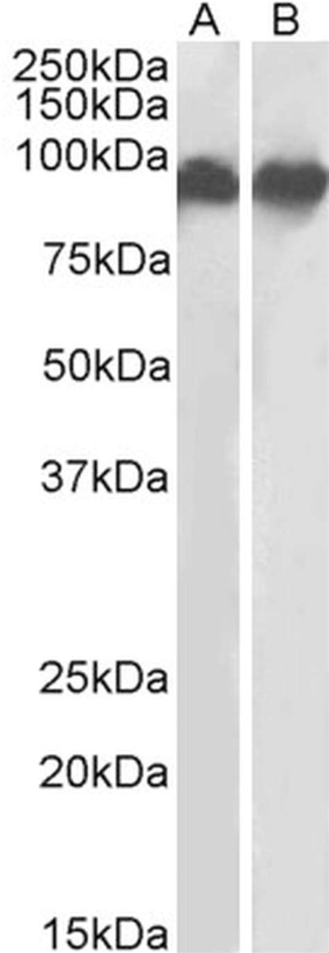 Cd18 Polyclonal Antibody Pa5 143202