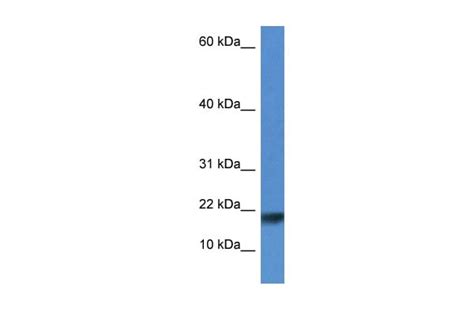 Iscu Antibody Pa5 70181