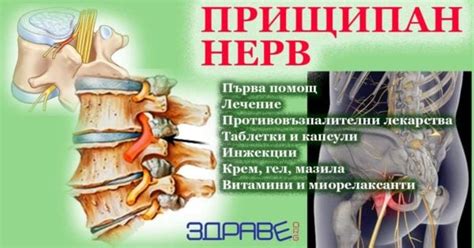 Прищипан нерв Техники за освобождаване На врата между ребрата