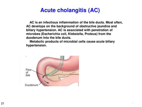 Obstructive Jaundice And Cholangitis Online Presentation