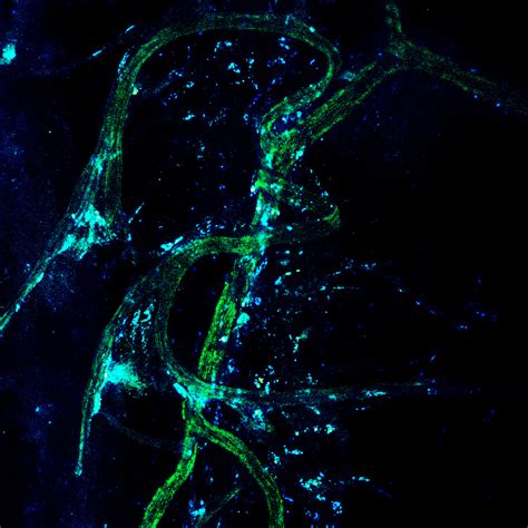 Sex Specific Pain Suppression By Immune Cells National Institutes Of Health NIH