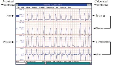 Advanced Codas Analysis Software Add On To Windaq By Dataq