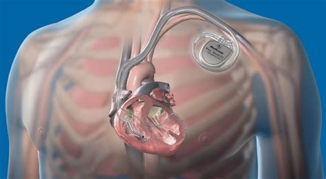Cardiology Infinity Care Hospital
