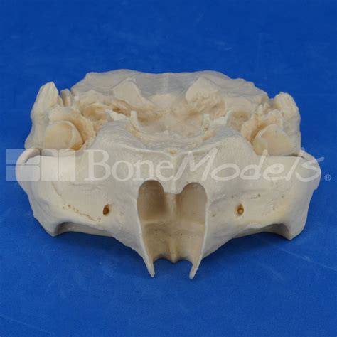 L 008a Edentulous Mandibular Model After Extractions Bonemodels Slu
