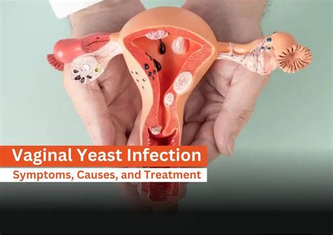 Vaginal Yeast Infection Symptoms Causes And Fast Relief Tips