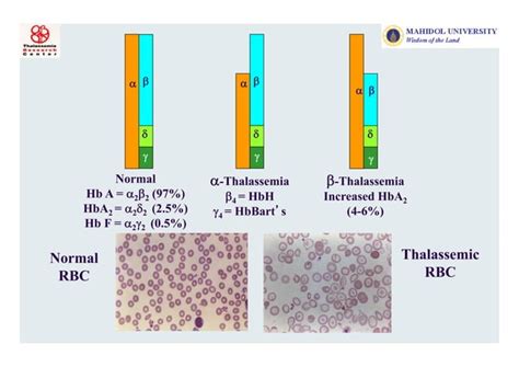 Overview Of Genotypes And Phenotypes Of Thalassemia In Asia Ppt