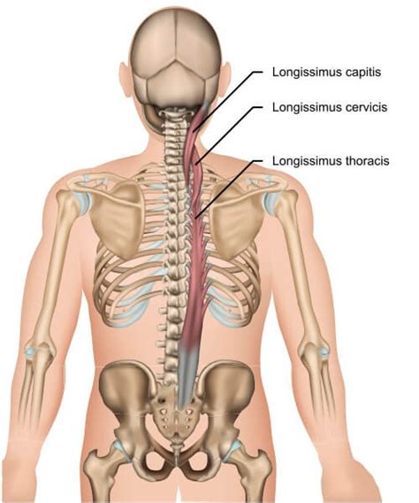 Erector Spinae Trigger Points Erector Spinae Trigger Points