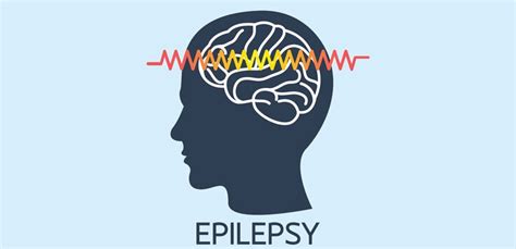 Heart Care Epilepsy Clinic