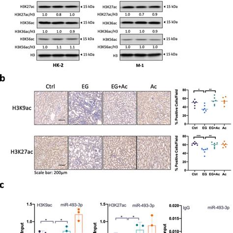 A Scheme Of Acetate Effect The Scheme Diagram Summarizes The Pathway Download Scientific
