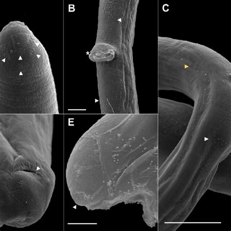 Scanning Electron Microscopy Of Female Capillaria Cairina N Sp A Download Scientific