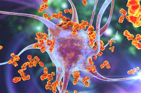 Inverse Vaccine” Reverses Autoimmune Diseases Like Ms Diabetes