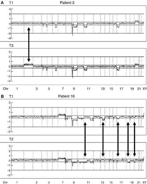 Graphical Representation Of Array Cgh Analysis Of Tumours From Patients