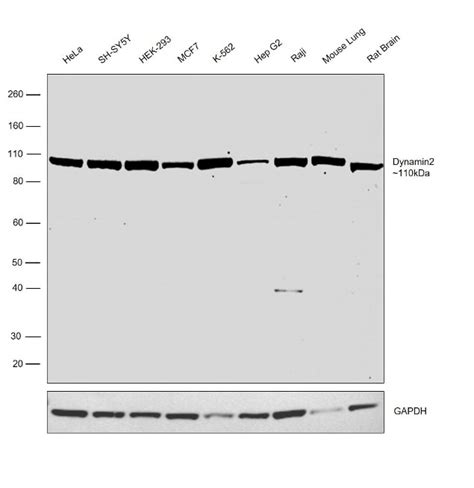 Dynamin 2 Antibody Pa5 19800