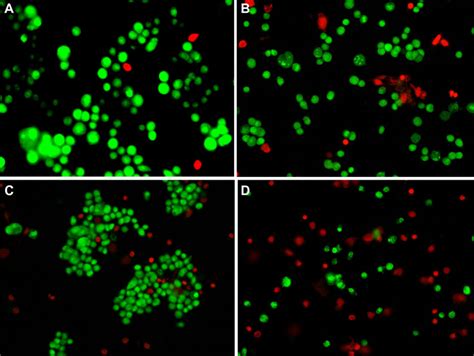 Fluorescence Micrographs Of Mcf 7 Cells Treated With Different