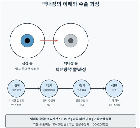 백내장 수술 꼭 받아야 할까 수술 시기부터 비용 회복까지 총정리