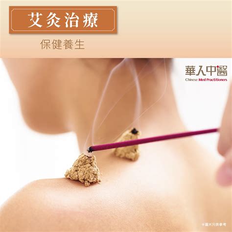 華人中醫 1 次 艾灸治療 Hktvmall 香港最大網購平台