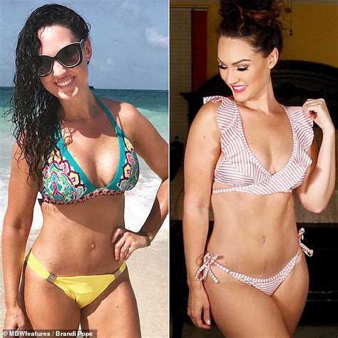 Former Mrs Virginia Left Suicidal And Bed Ridden In Agonizing Pain By