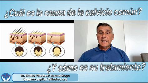 6 SALUD FM Dr Villodres Causas de la calvicie común y su