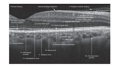 layers of retina over oct and histology pptx