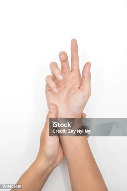 Ulnar Claw Hand Of Asian Young Man Also Known As Spinster Claw Stock