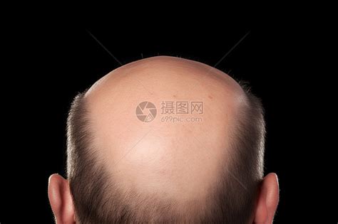 秃头男子高清图片下载 正版图片600901694 摄图网