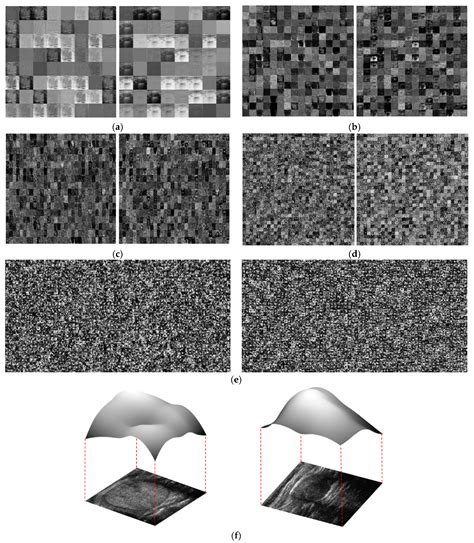 Artificial Intelligence Based Thyroid Nodule Classification Using Information From Spatial And