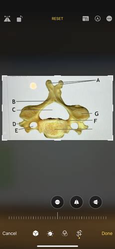 Procedures Chapter 8 Quiz Flashcards Quizlet